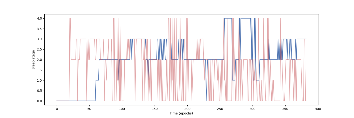 Sleep staging on the Sleep Physionet dataset using Chambon2018 network — Braindecode 1.3.0 ...