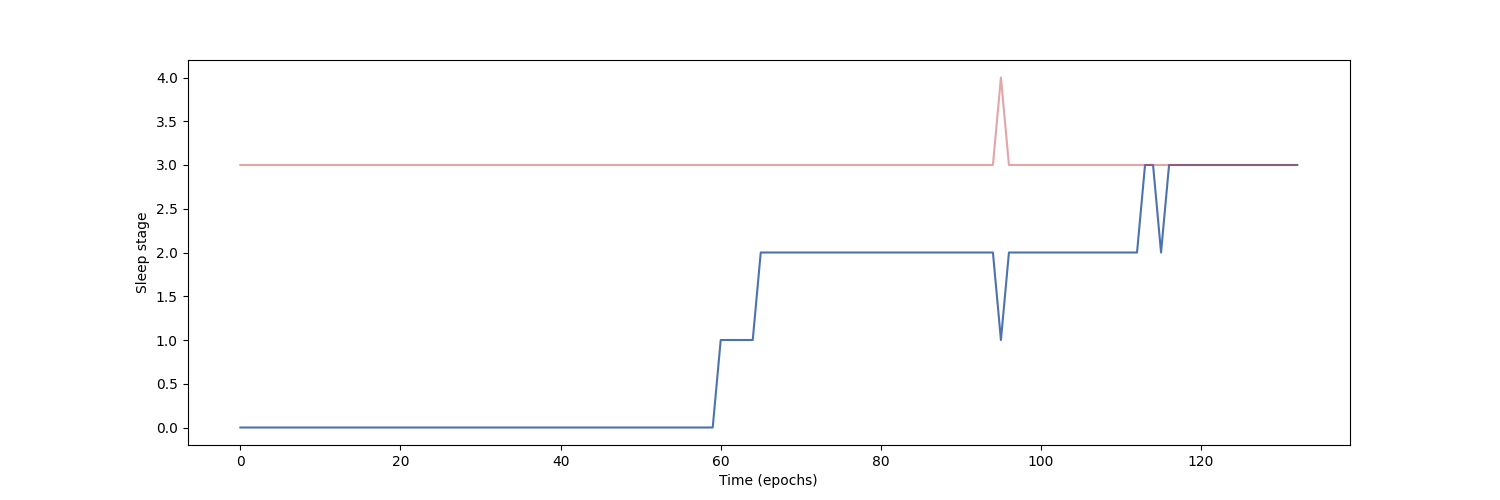 Sleep staging on the Sleep Physionet dataset using Eldele2021 ...