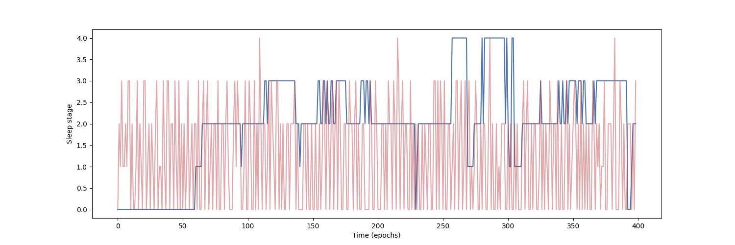 Sleep staging on the Sleep Physionet dataset using U-Sleep network ...